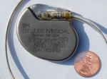 The Future is Here: The Perpetual Motion Pacemaker! – Stories by Williams